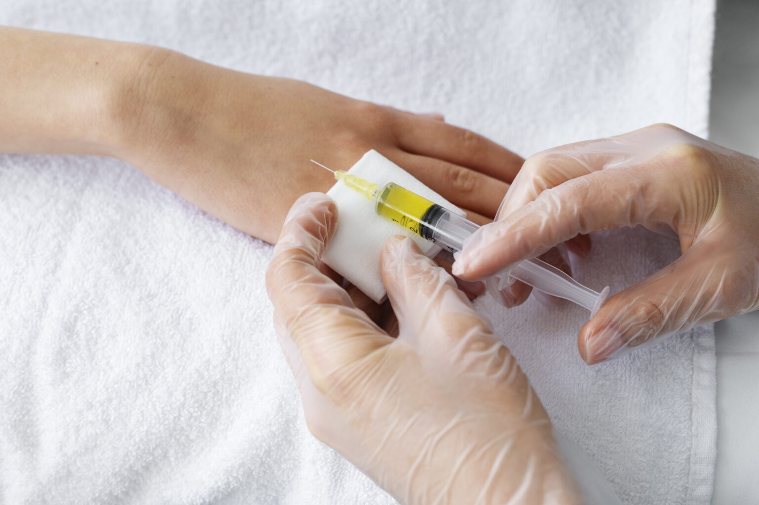 What to Expect During a PRP Injection: A Step-by-Step Guide - Dr John PRP